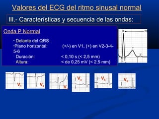 Electrocardiograma normal wab | PPT