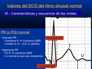Electrocardiograma normal wab | PPT