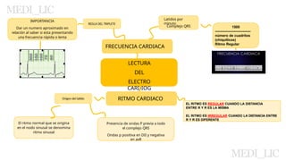 ELECTROCARDIOGRAMA CARACTERISTICAS_PPT.pptx