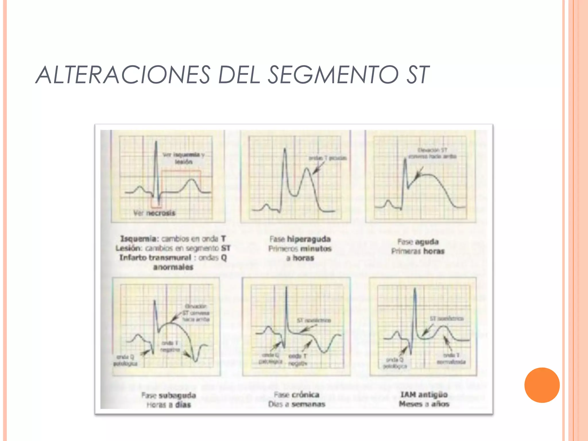 Electrocardiograma (ECG) básico | PPT | Heart and Cardiovascular ...