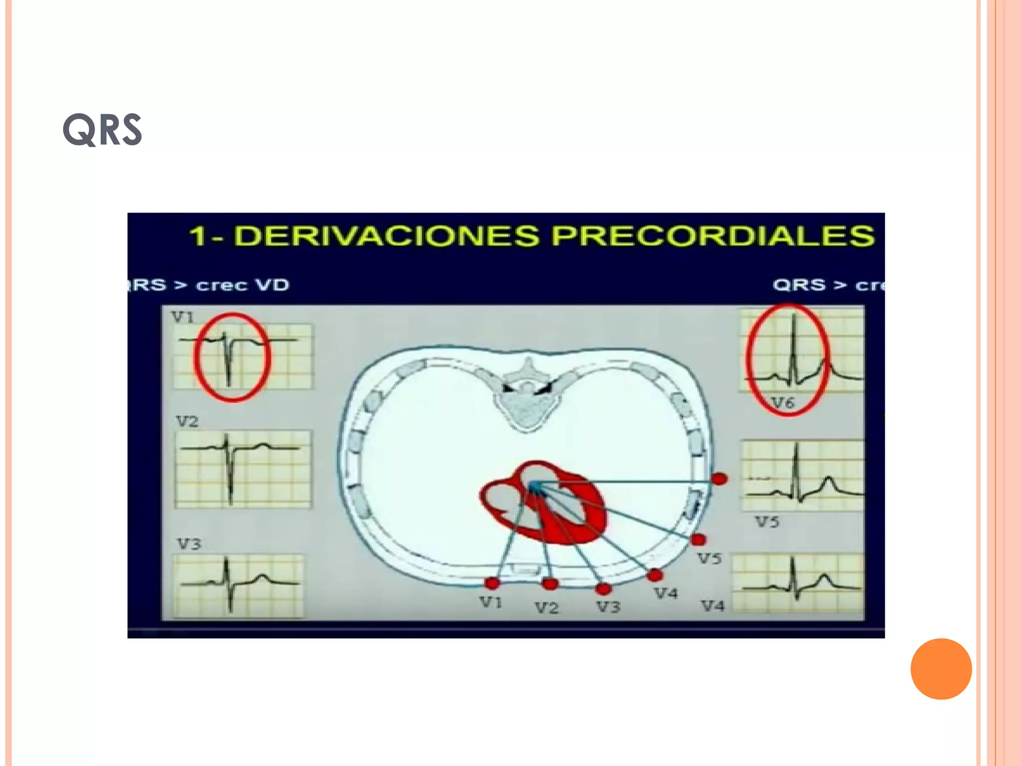 Electrocardiograma (ECG) básico | PPT | Heart and Cardiovascular ...