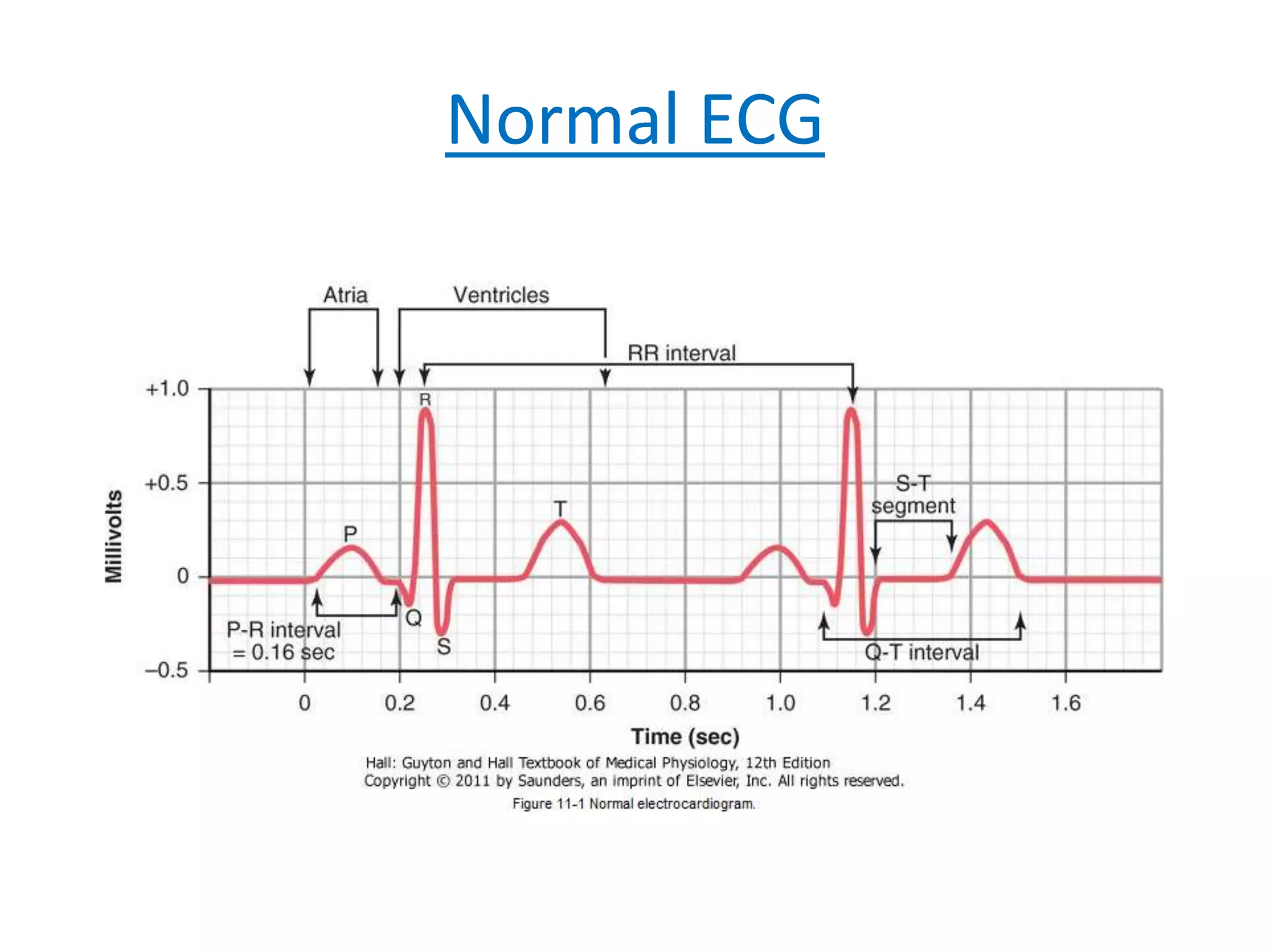 Electrocardiogram (ECG) | PPTX | Heart and Cardiovascular Diseases ...