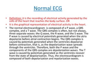 Electrocardiogram (ECG) | PPTX | Heart and Cardiovascular Diseases ...