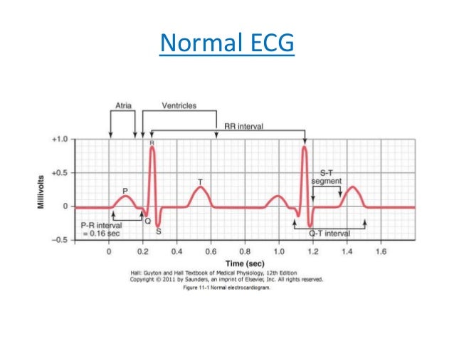 Electrocardiogram (ECG)