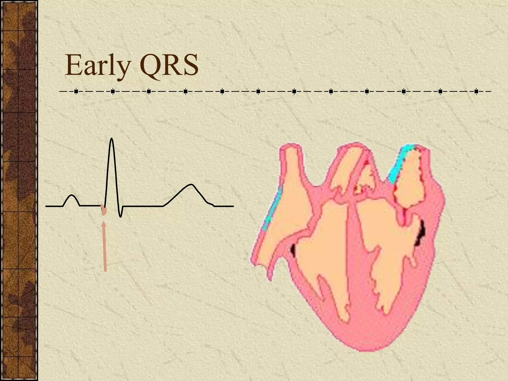 Electrocardiogram(ecg) | PPT