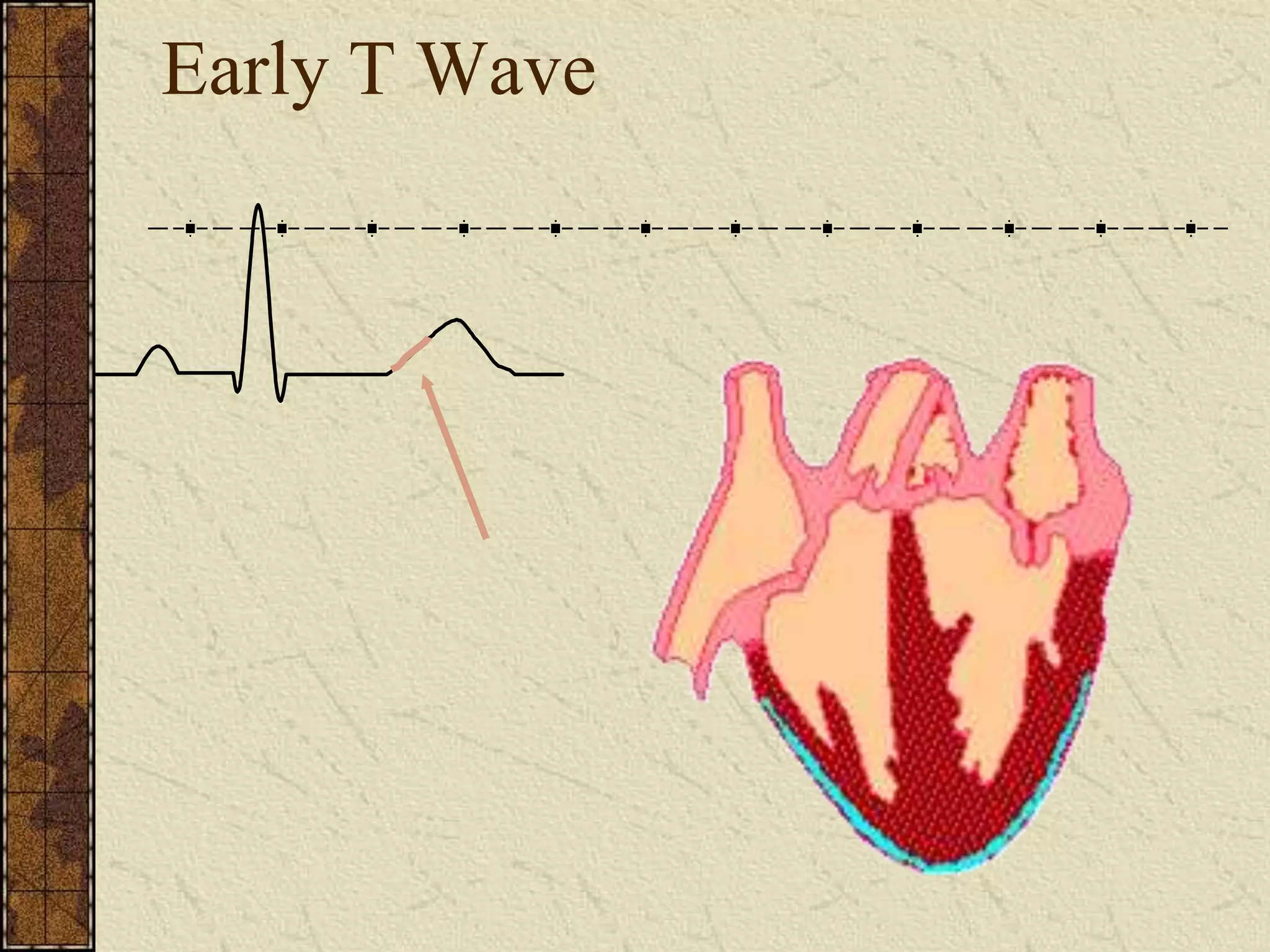 Electrocardiogram(ecg) | PPT