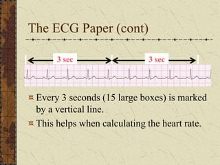 Electrocardiogram(ecg) | PPT