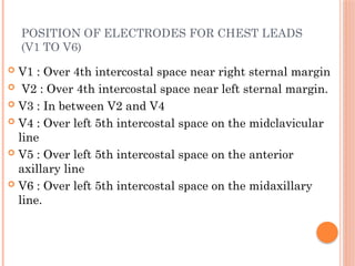 Electrocardiogram__ECG_.pptx Electrocardiograph – Is an instrument by ...