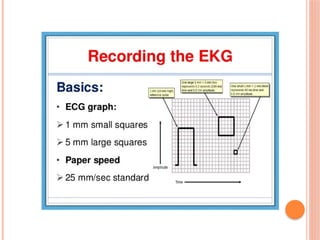 Electrocardiogram__ECG_.pptx Electrocardiograph – Is an instrument by ...