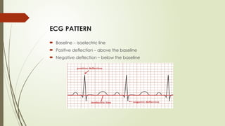ELECTRO CARDIOGRAM (ECG) FINDING FOR NURSES | PPT