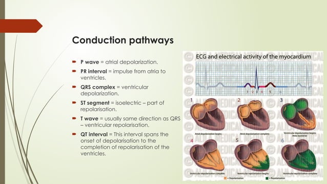 ELECTRO CARDIOGRAM (ECG) FINDING FOR NURSES | PPTX
