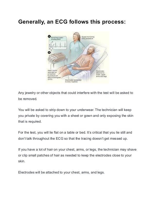 Electrocardiogram (ECG) Machine.pdf