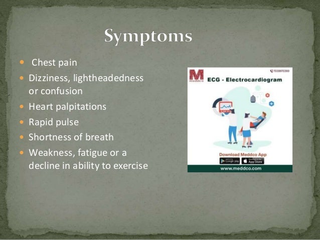 Electrocardiograms | PPTX
