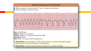 Electrocardiography,cvp,blood pressure | PPT