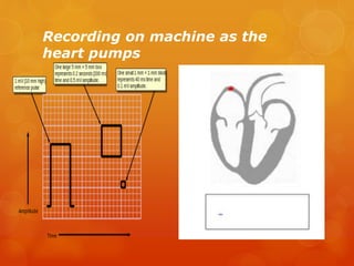 Electrocardiography | PPTX