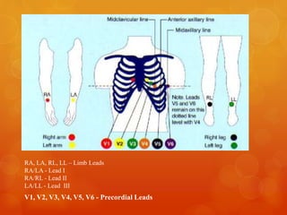 Electrocardiography | PPTX