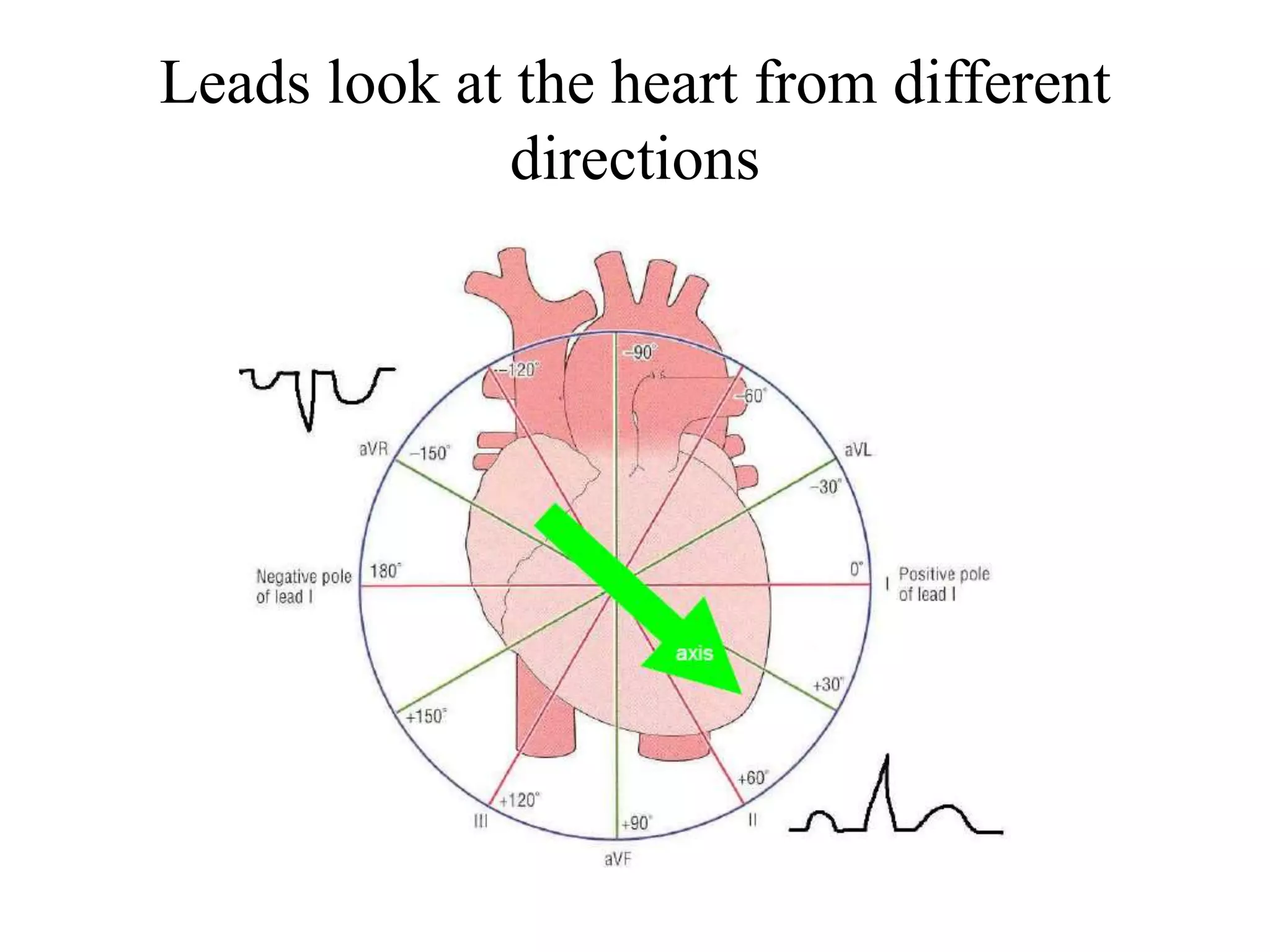 Electro cardiography in pediatrics | PPT