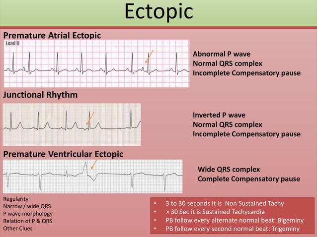 Electrocardiography basics 2022 | PPT