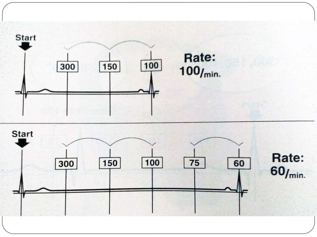 Electrocardiography (ecg)