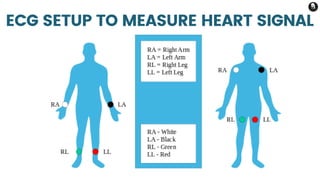 Electrocardiography (ecg) - Electrical Signal of Human Heart | PDF