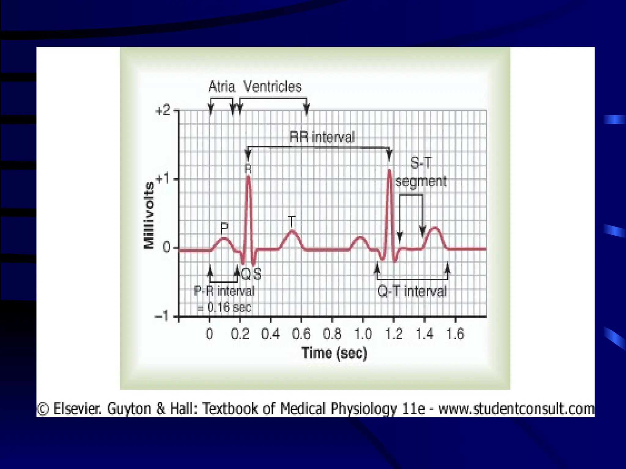 Electrocardiography (ECG), Physiology Lectures series by Dr. Naqvi.pptx