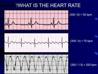 Electrocardiography (ECG), Physiology Lectures series by Dr. Naqvi.pptx