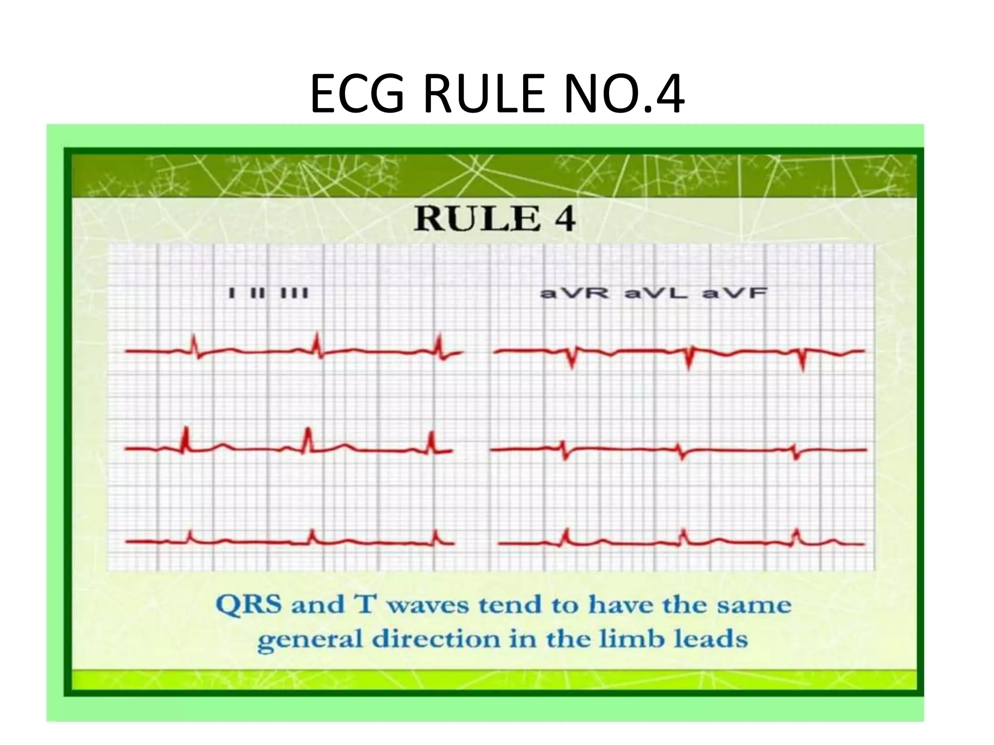 ELECTRO CARDIO GRAPHY (ECG) ppt.pptx