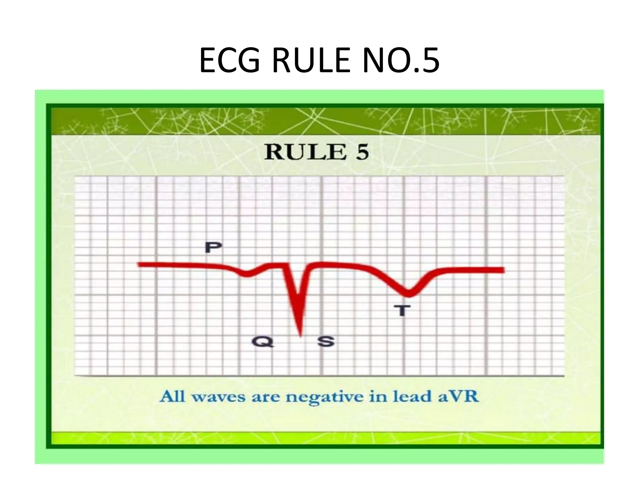 ELECTRO CARDIO GRAPHY (ECG) ppt.pptx