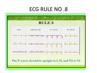 ELECTRO CARDIO GRAPHY (ECG) ppt.pptx