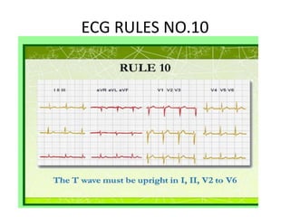 ELECTRO CARDIO GRAPHY (ECG) ppt.pptx