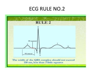 ELECTRO CARDIO GRAPHY (ECG) ppt.pptx