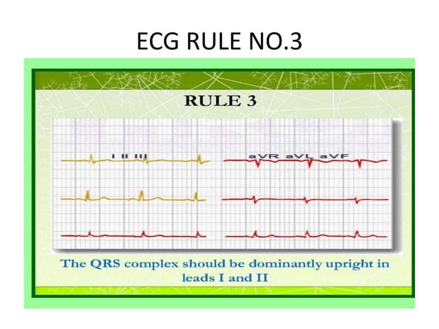 ELECTRO CARDIO GRAPHY (ECG) ppt.pptx