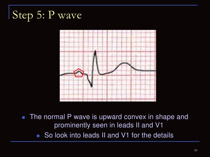Electrocardiography for Students