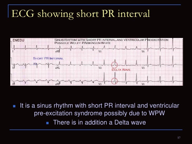 Electrocardiography for Students
