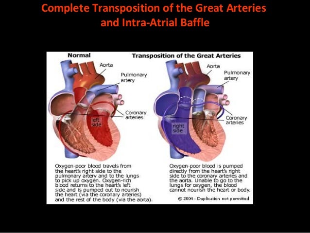Electrocardiography in Adult Congenital Heart Diseases