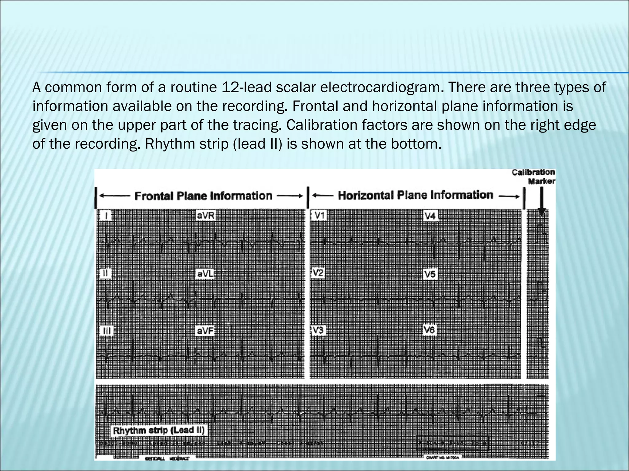 Electrocardiographymain | PPT