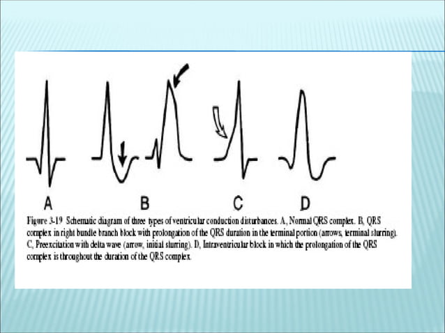 Electrocardiographymain | PPT