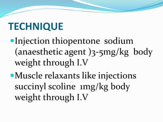 Electro convulsive therapy | PPTX