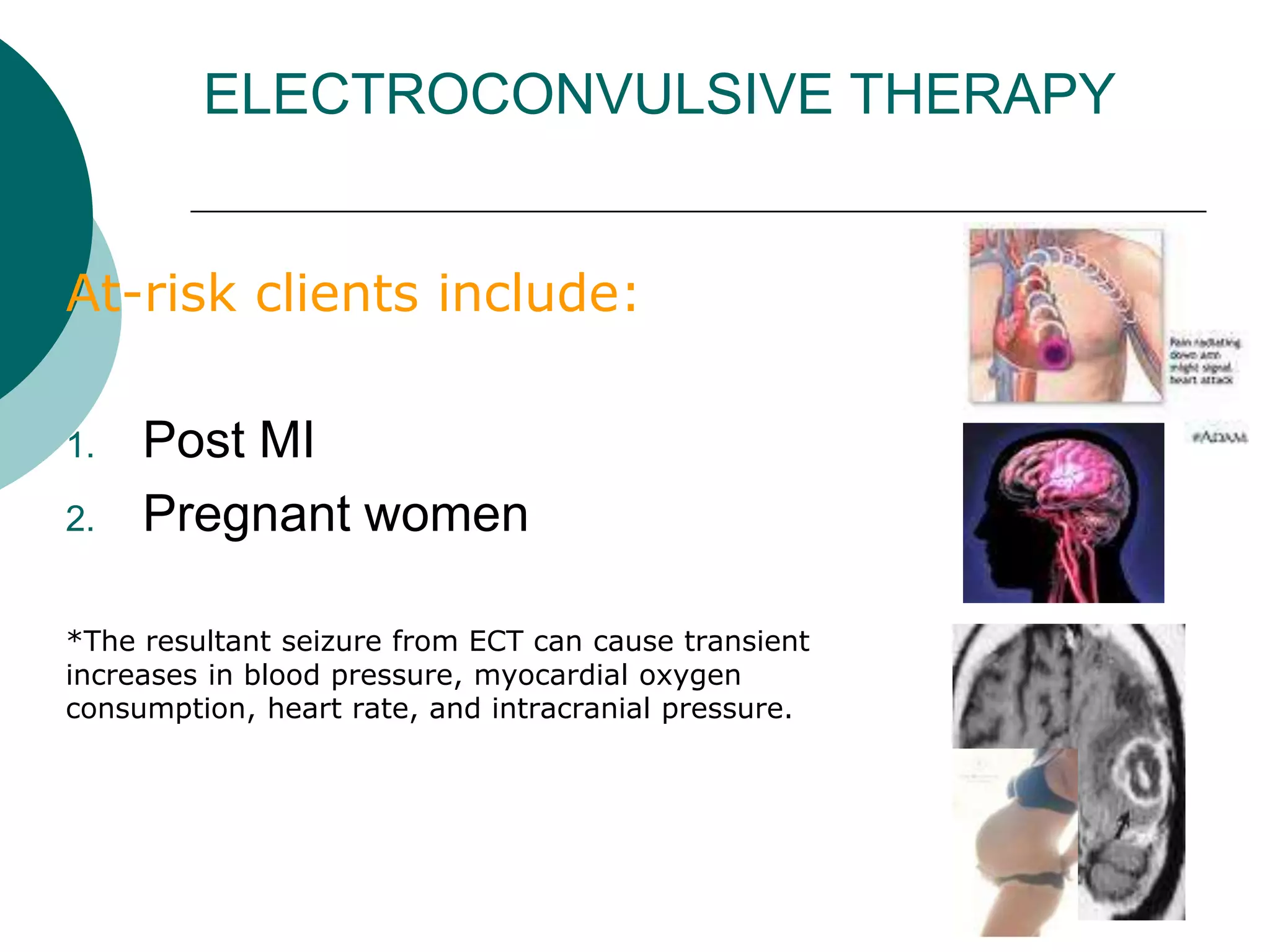 Electroconvulsive-Therapy.ppt