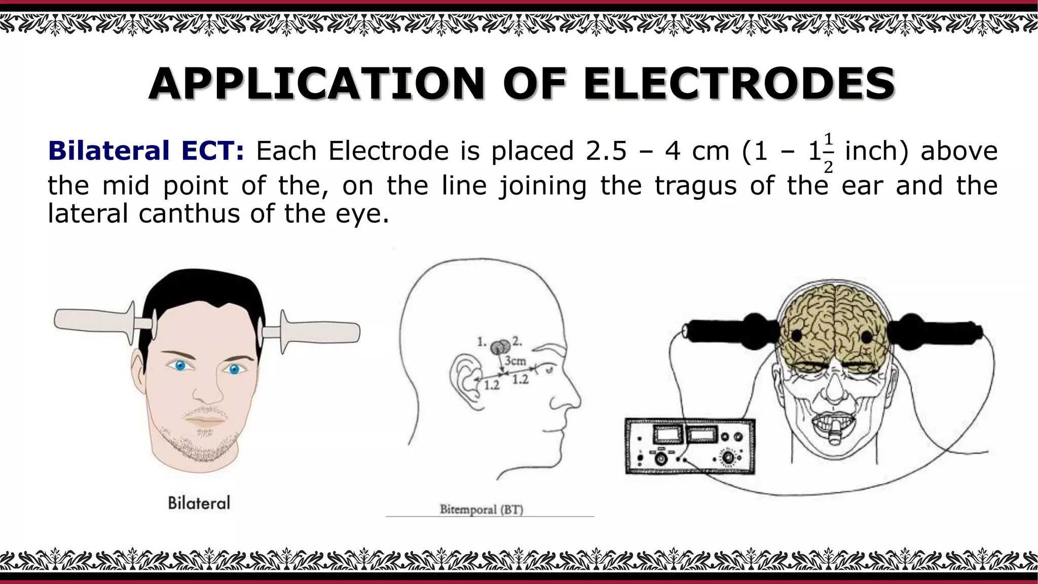 Electro convulsive therapy | PPTX