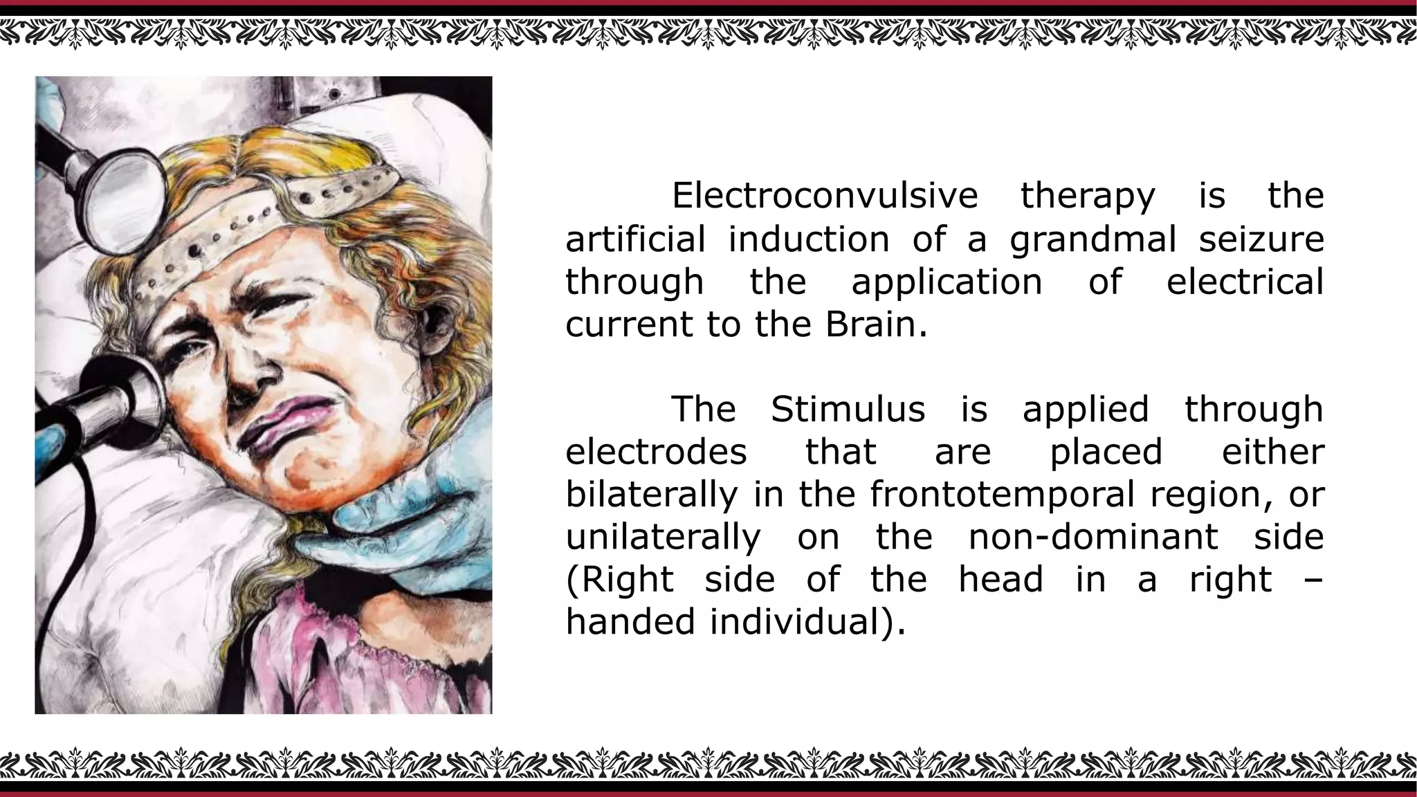 Electro convulsive therapy | PPTX