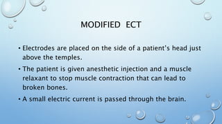 Electroconvulsive therapy | PPTX