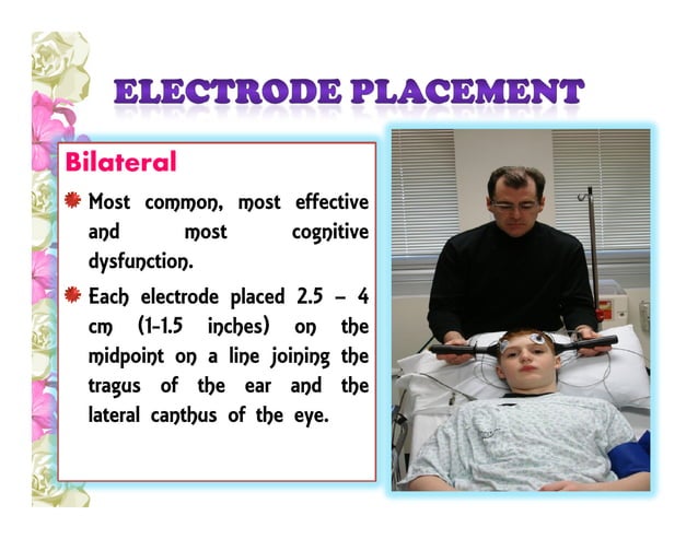 Electro convulsive therapy (ECT) | PDF