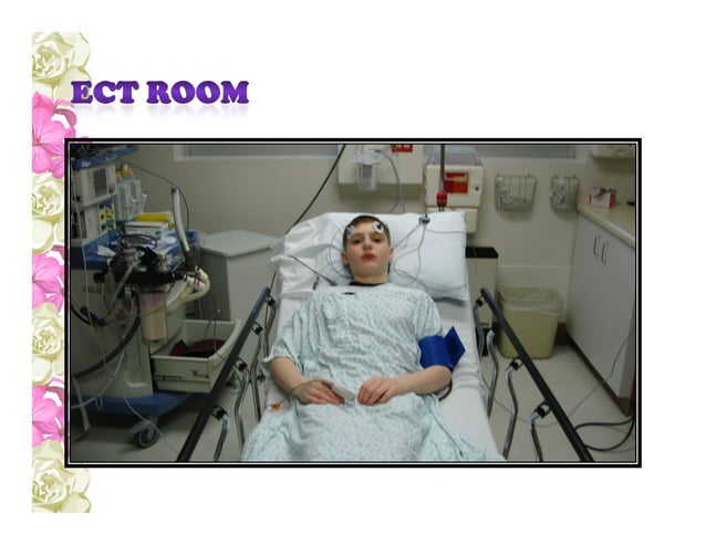 Electro convulsive therapy (ECT) | PDF