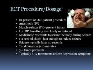 Electroconvulsiv Therapy Presentation | PPT