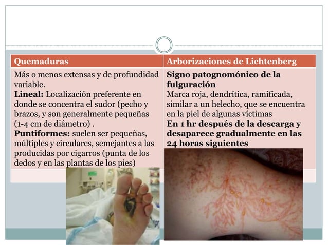 Electrocucion y Fulguracion | PPT