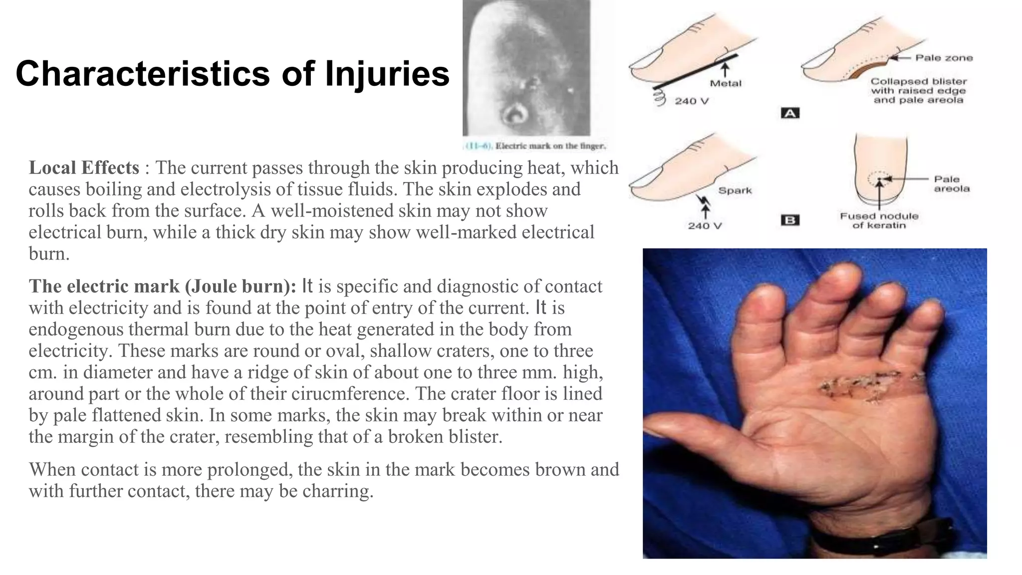 Electrocution (1) | PPTX