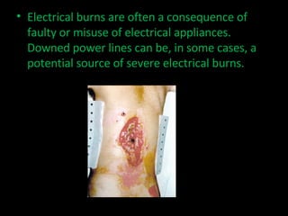 Electrocution-1 | PPT