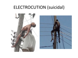 Electrocution