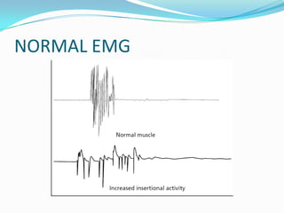 Electrodiagnosis 1 | PPTX